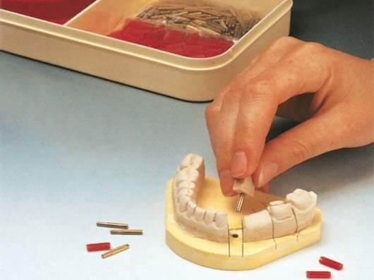 Crosspin (Nordent) | Sky Dental Supply