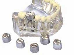 Tin Crown (Directa) | Sky Dental Supply