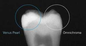 Venus Pearl One | Sky Dental Supply