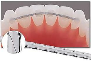 Attachments | Sky Dental Supply